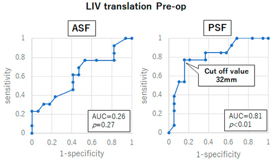 JCM | Free Full-Text | Influence of Lateral Translation of Lowest ...