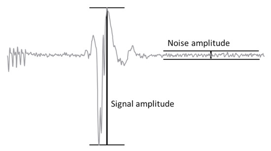 JCM | Free Full-Text | Comparing Motor-Evoked Potential Characteristics ...