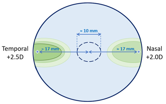 Peripheral Refraction and Visual Function of Novel Perifocal Ophthalmic ...