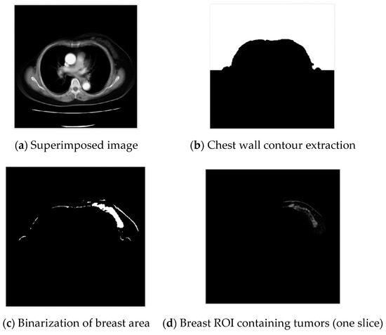 JCM | Free Full-Text | Complete, Fully Automatic Detection and ...