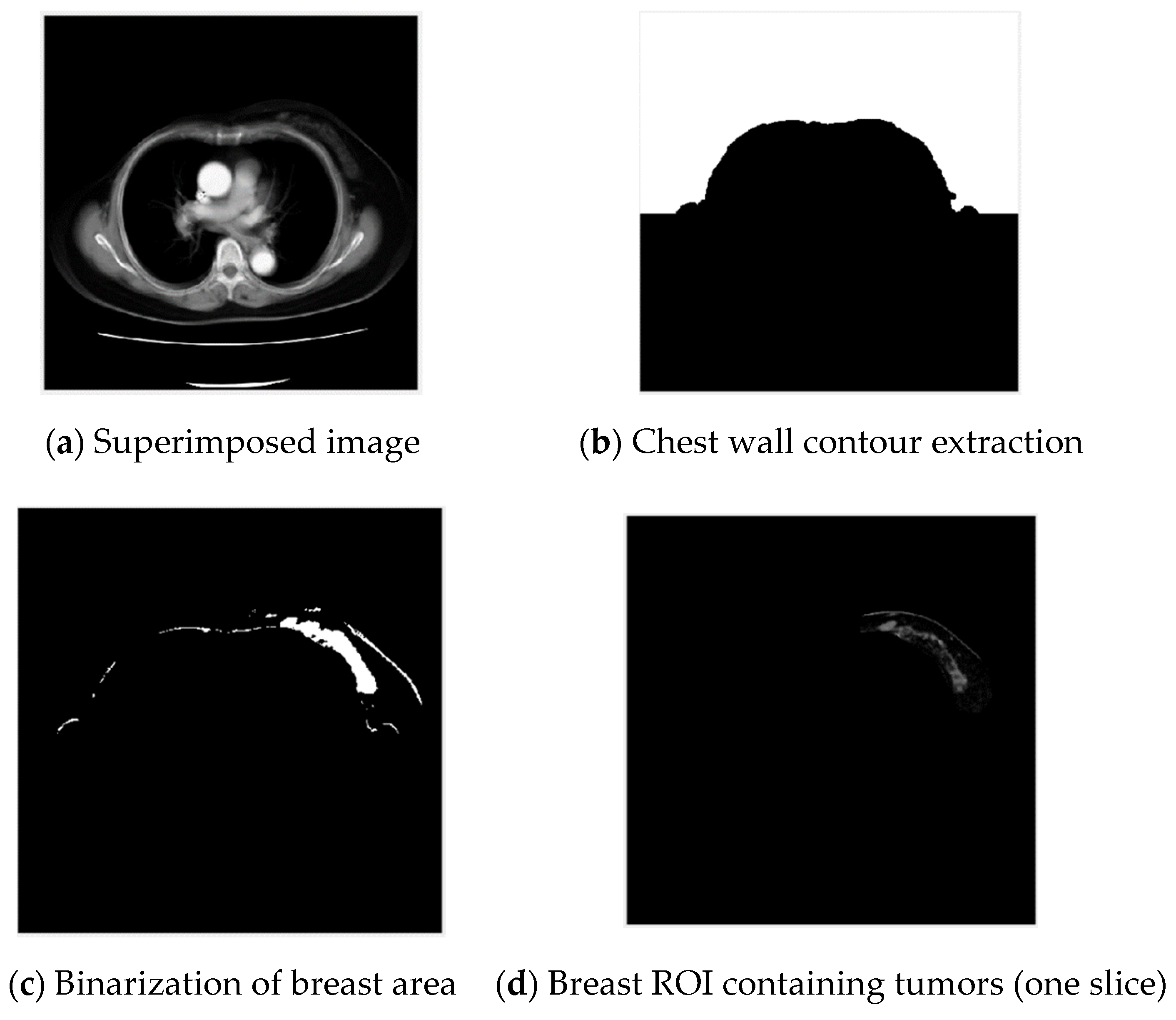 JCM | Free Full-Text | Complete, Fully Automatic Detection and ...