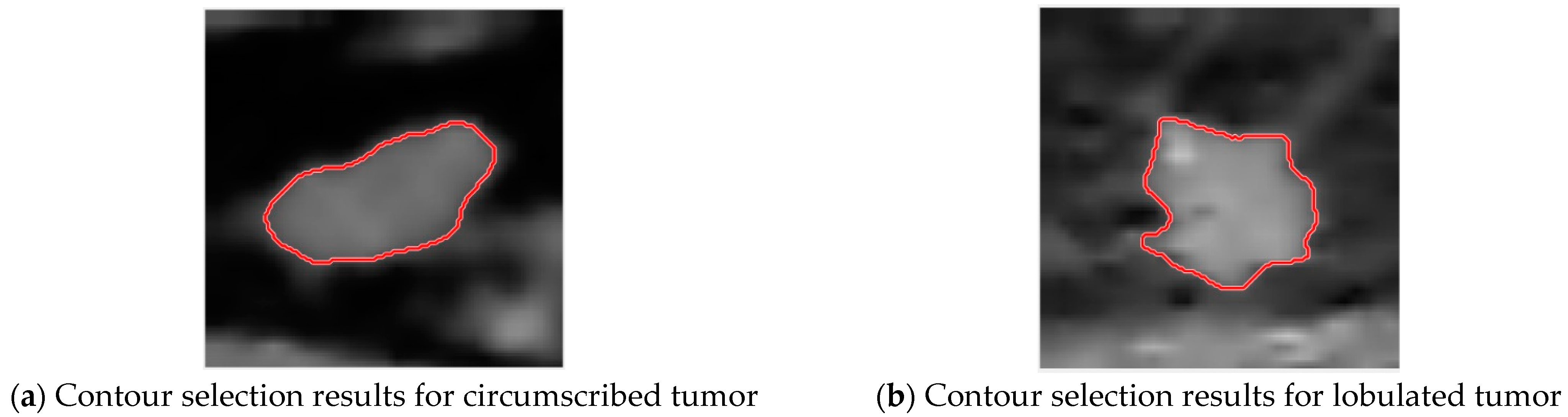 JCM | Free Full-Text | Complete, Fully Automatic Detection and ...