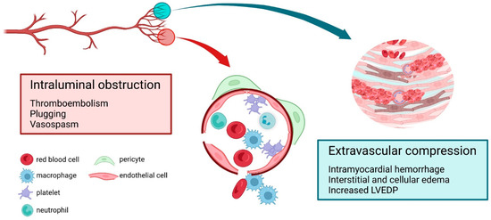 Coronary Microcirculation: The Next Frontier in the Management of STEMI