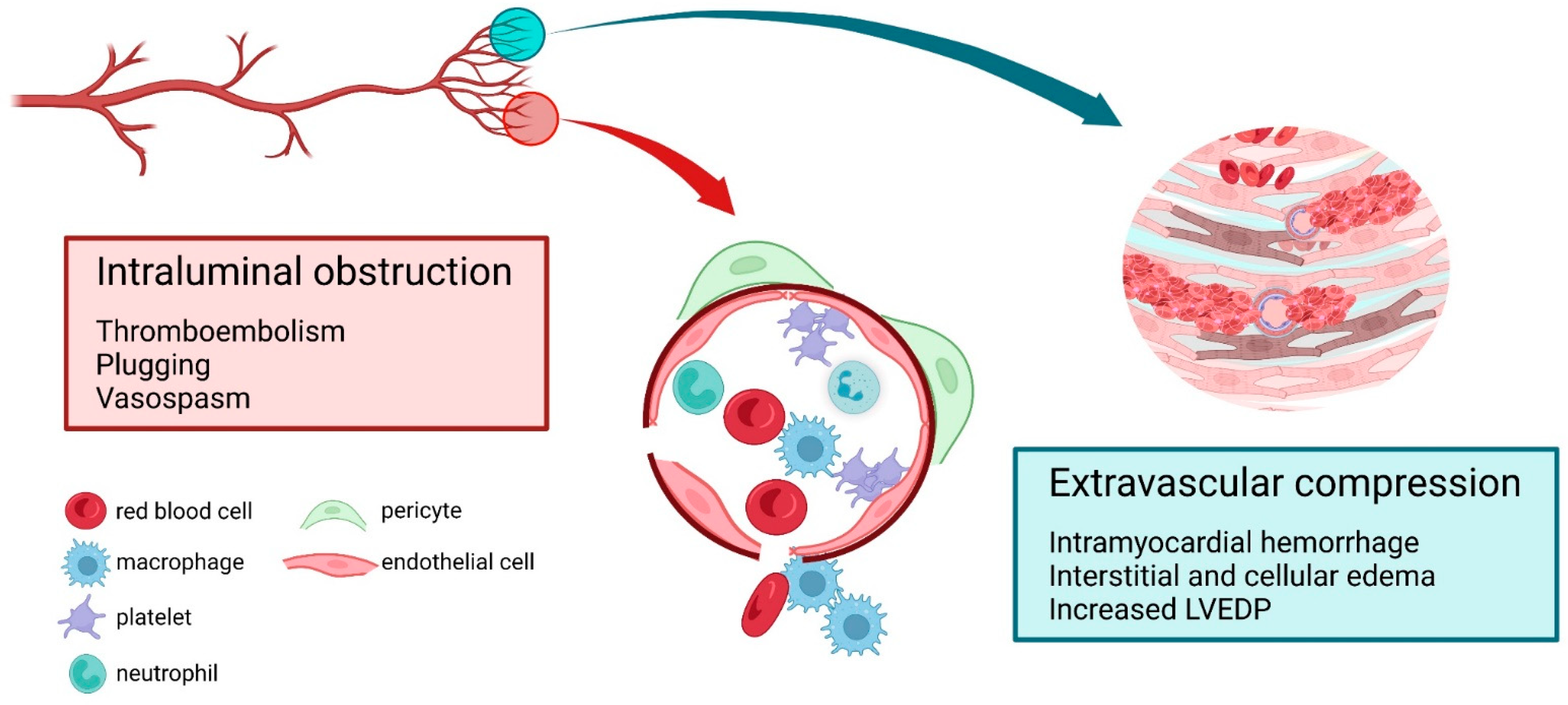 JCM | Free Full-Text | Coronary Microcirculation: The Next Frontier in ...