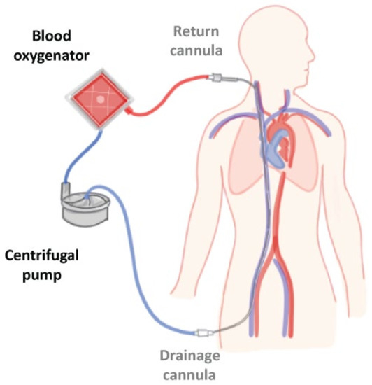 Simulators and Simulations for Extracorporeal Membrane Oxygenation: An ...