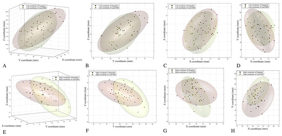 Deep Brain Stimulation Electrode Reconstruction: Comparison between ...