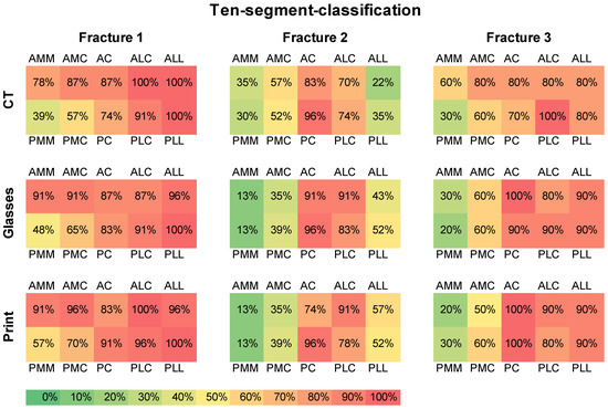 Preoperative Mixed-Reality Visualization of Complex Tibial Plateau ...