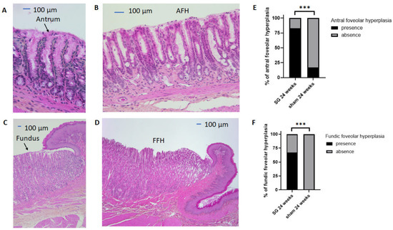 No Long-Term Mucosal Lesions in the Esophagus but More Gastric Mucosal ...
