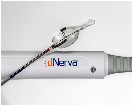 Modern Bronchoscopic Treatment Options for Patients with Chronic Bronchitis