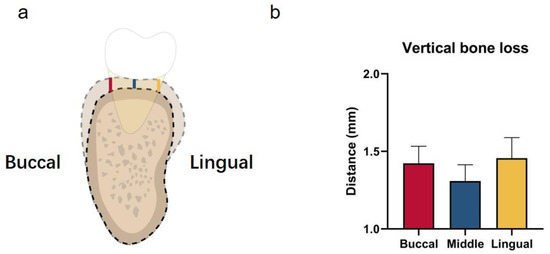 Characteristics of Spatial Changes in Molars and Alveolar Bone ...