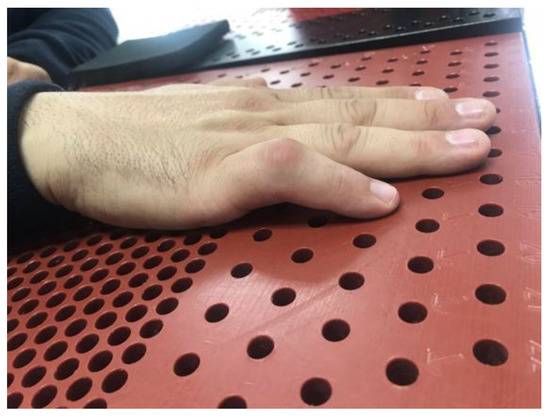 A Comparison between Two Intervals of Daily Total End Range Time for ...