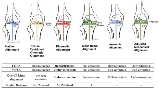 Clinical and Radiographic Outcomes of Inversed Restricted Kinematic Alignment Total Knee ...