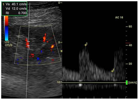 JCM | Free Full-Text | Ultrasound Doppler Flow Parameters Are ...