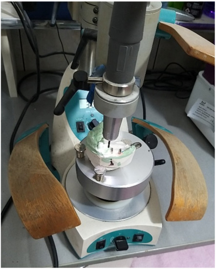 Comparative Study of Dental Custom CAD-CAM Implant Abutments and Dental ...