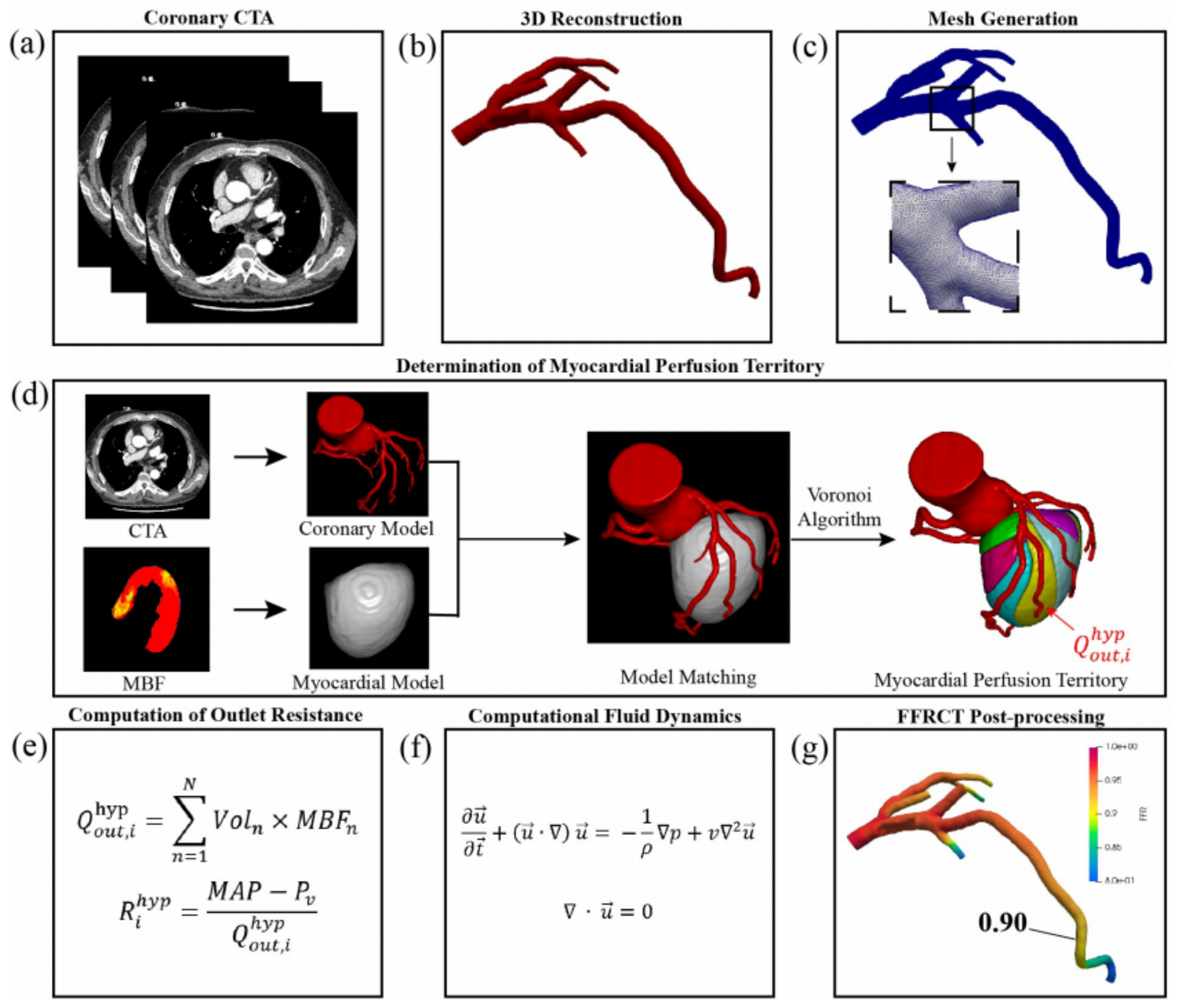 A Novel CT Perfusion-Based Fractional Flow Reserve Algorithm for Detecting Coronary Artery Disease