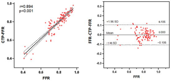 A Novel CT Perfusion-Based Fractional Flow Reserve Algorithm for ...