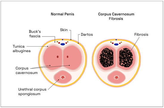 Rats, Neuregulins and Radical Prostatectomy: A Conceptual Overview