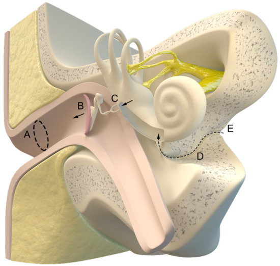 Non-Invasive Intracranial Pressure Monitoring