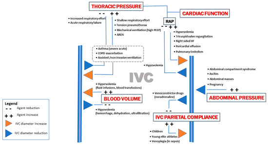 JCM | Free Full-Text | Inferior Vena Cava Ultrasonography for Volume ...