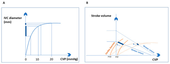 JCM | Free Full-Text | Inferior Vena Cava Ultrasonography for Volume ...