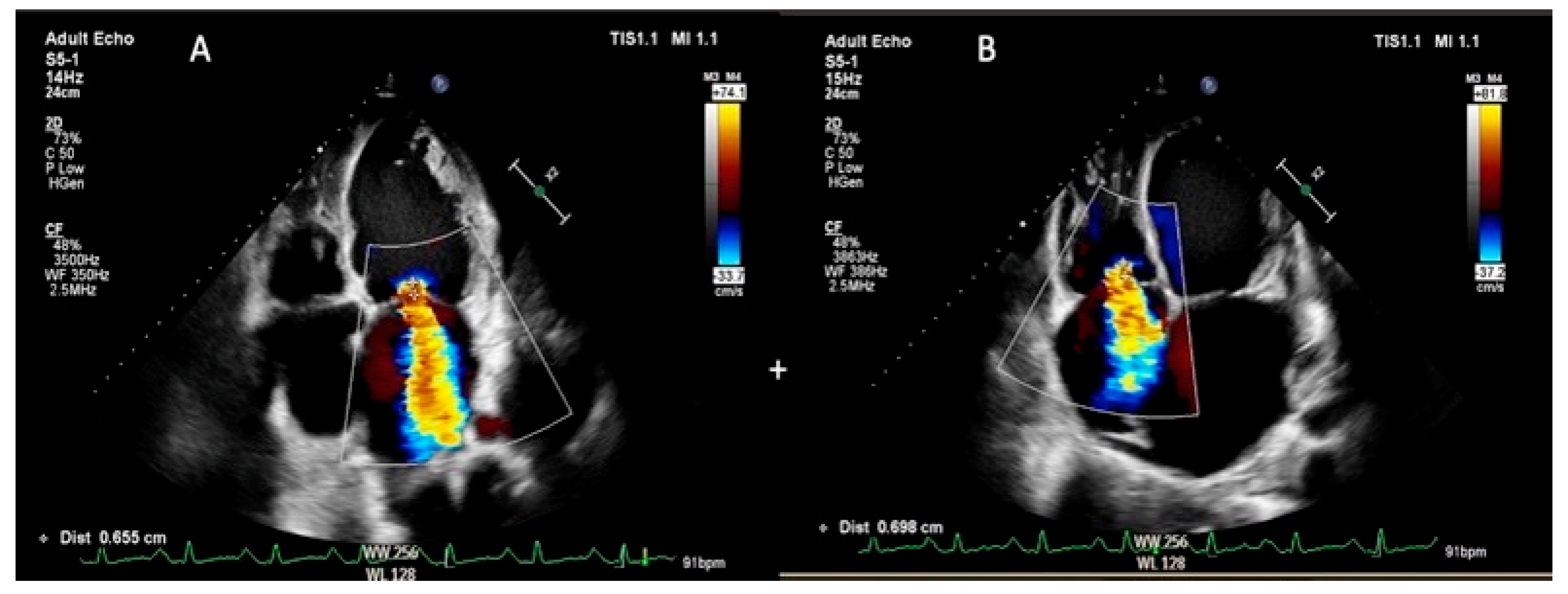 Relationships of Whole-Heart Myocardial Mechanics and Cardiac ...