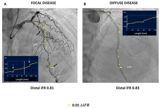 JCM | Free Full-Text | Coronary Physiology: Modern Concepts for the ...