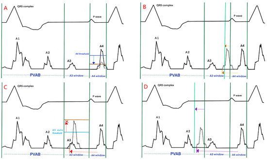 JCM | Free Full-Text | Strategies for Safe Implantation and Effective ...