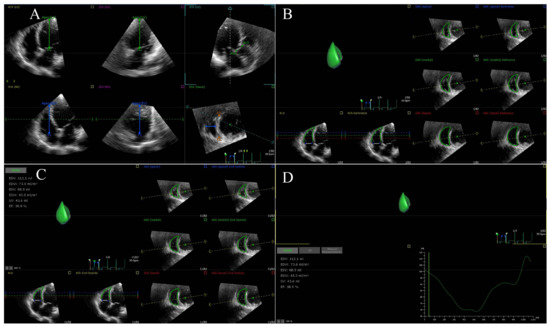 Clinical Usefulness of Right Ventricle–Pulmonary Artery Coupling in ...