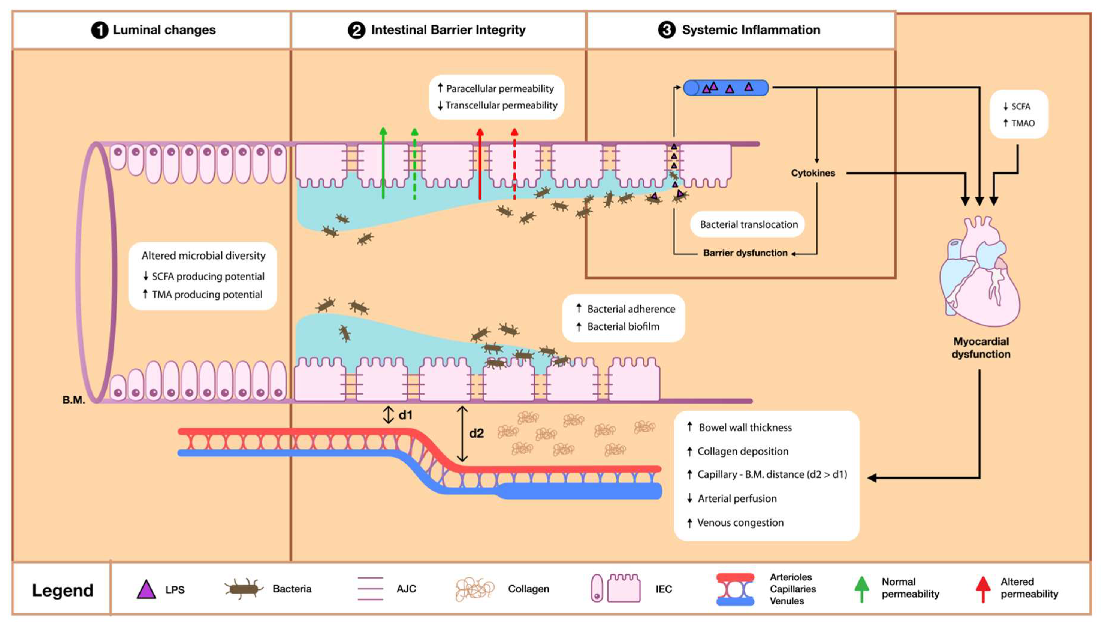 Gut Failure: A Review of the Pathophysiology and Therapeutic Potentials ...