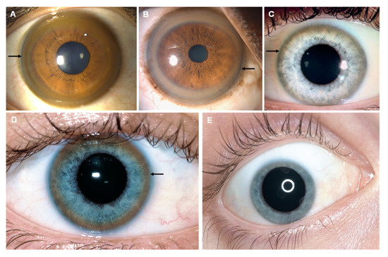 JCM | Free Full-Text | Clinical and Forensic Signs Resulting from ...