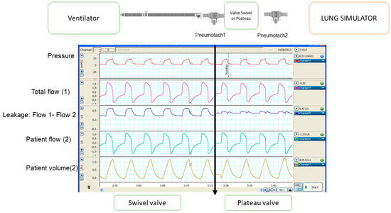 What Circuits, Masks and Filters Should Be Used in Home Non-Invasive ...
