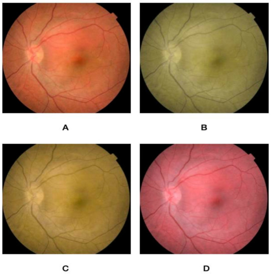 The Impact of Color Vision Deficiency on the Capability of ...