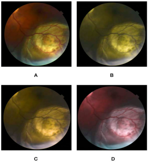 The Impact of Color Vision Deficiency on the Capability of ...