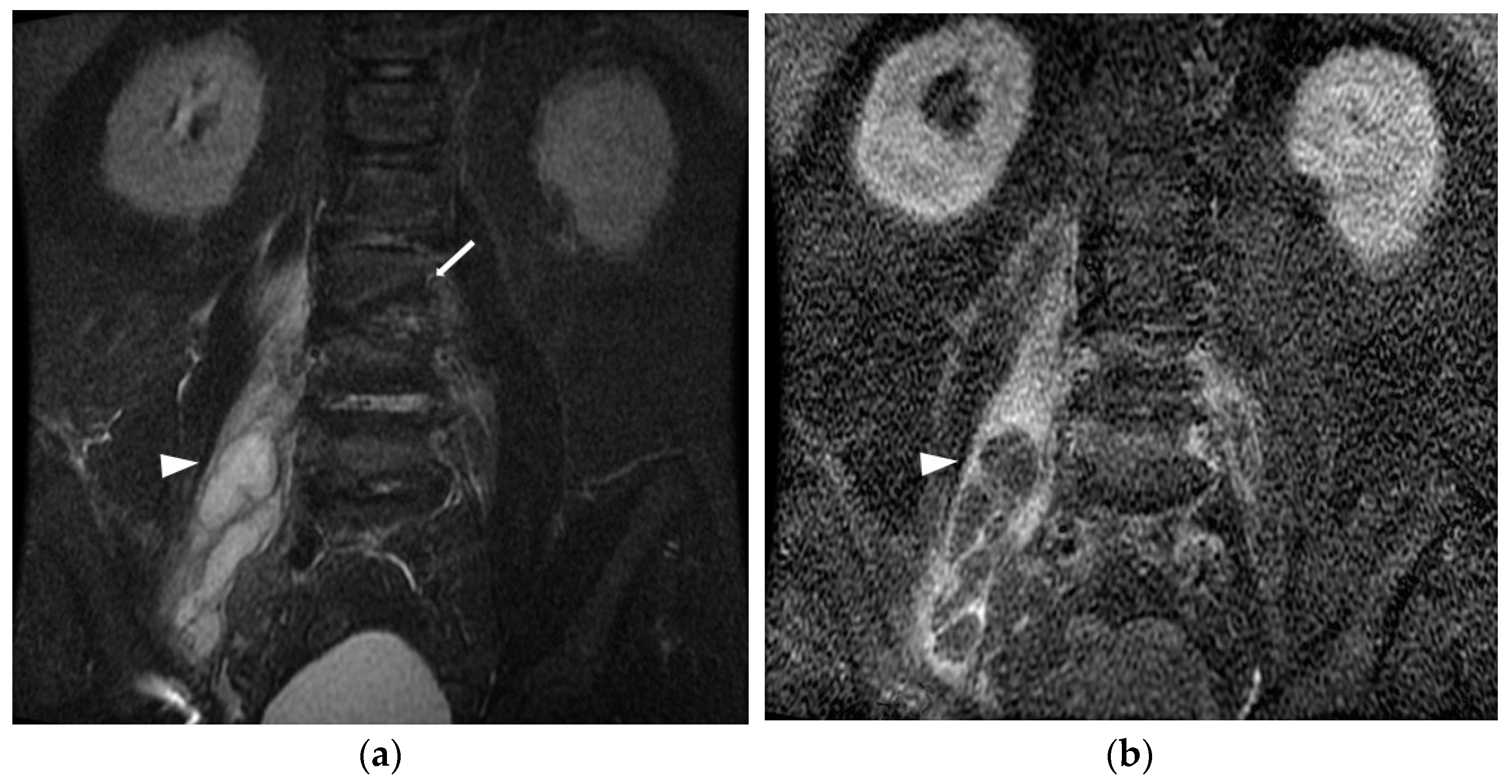 JCM | Free Full-Text | Clinical Characteristics and In-Hospital ... JCM | Free Full-Text | Clinical Characteristics and In-Hospital ...