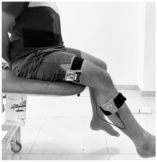 Investigating Knee Joint Proprioception and Its Impact on Limits of ...