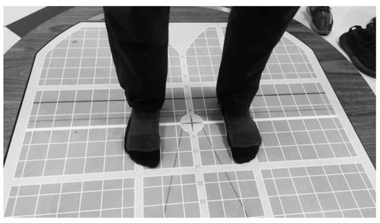 Investigating Knee Joint Proprioception and Its Impact on Limits of ...