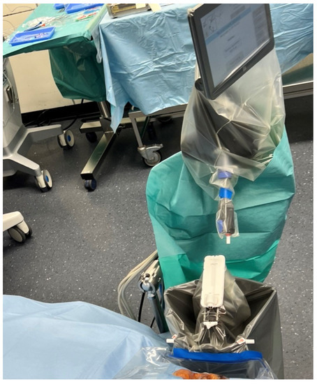 Robot-Assisted Epiretinal Membrane Peeling: A Prospective Assessment of ...