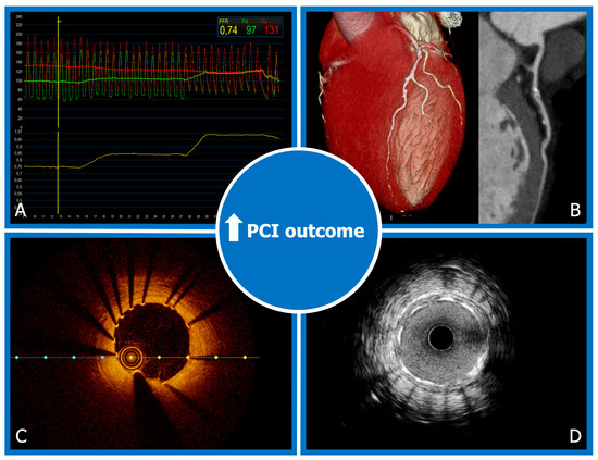 Revascularization and Medical Therapy for Chronic Coronary Syndromes ...