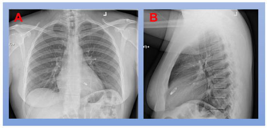 Paradigm Shifts in Cardiac Pacing: Where Have We Been and What Lies Ahead?