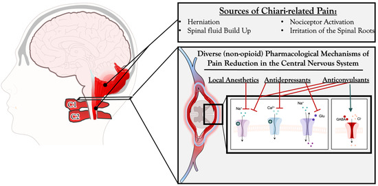 JCM | Free Full-Text | A Systematic Review of Non-Opioid Pain ...