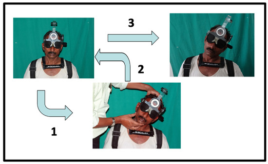 A Cross-Sectional Study on Mediating Effect of Chronic Pain on the ...