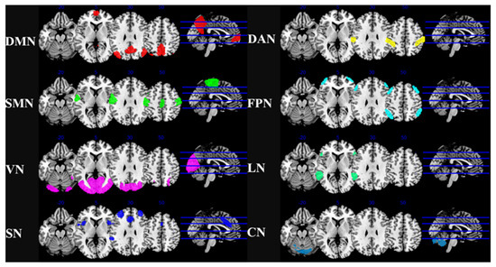 Widespread Intra- and Inter-Network Dysconnectivity among Large-Scale ...