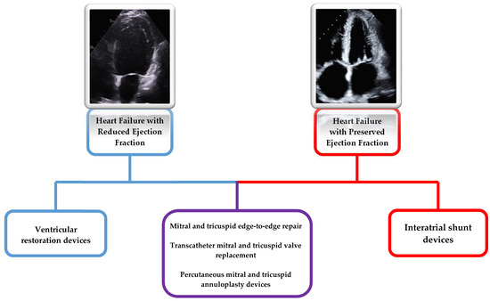 JCM | Free Full-Text | Structural Interventions in Heart Failure ...