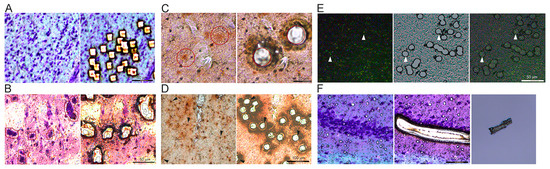 Microisolation of Spatially Characterized Single Populations of Neurons ...