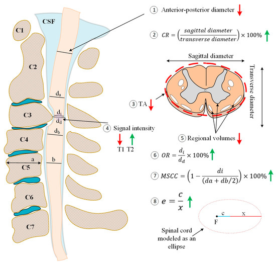 Utility of MRI in Quantifying Tissue Injury in Cervical Spondylotic ...