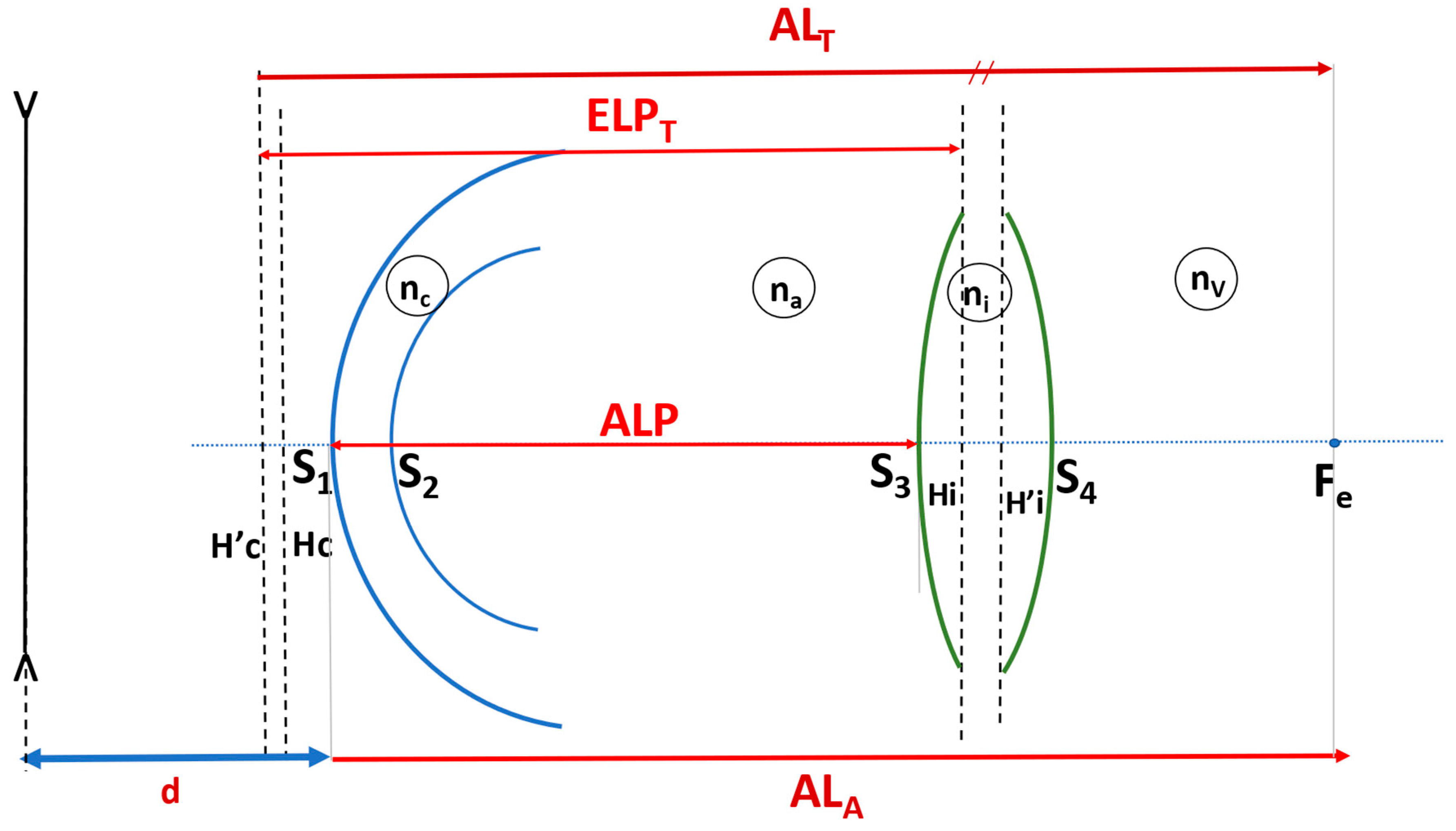 Theoretical Impact of Intraocular Lens Design Variations on the ...