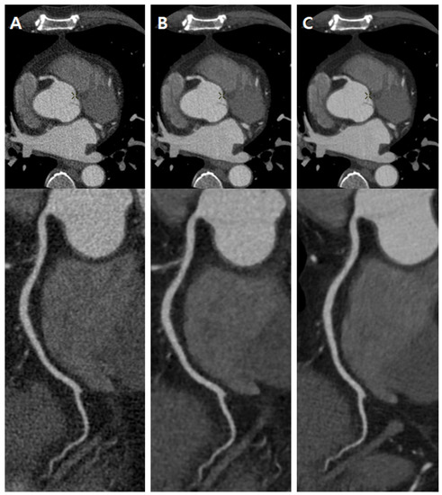 JCM | Free Full-Text | Clinical Feasibility of Deep Learning-Based ...