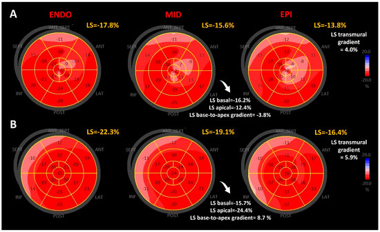 Multimodality Imaging and Biomarker Approach to Characterize the ...