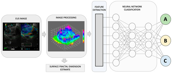 A Comprehensive Guide to Artificial Intelligence in Endoscopic Ultrasound