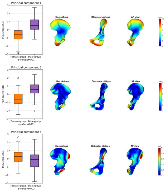 Development of a Statistical Shape Model and Assessment of Anatomical Shape Variations in the ...